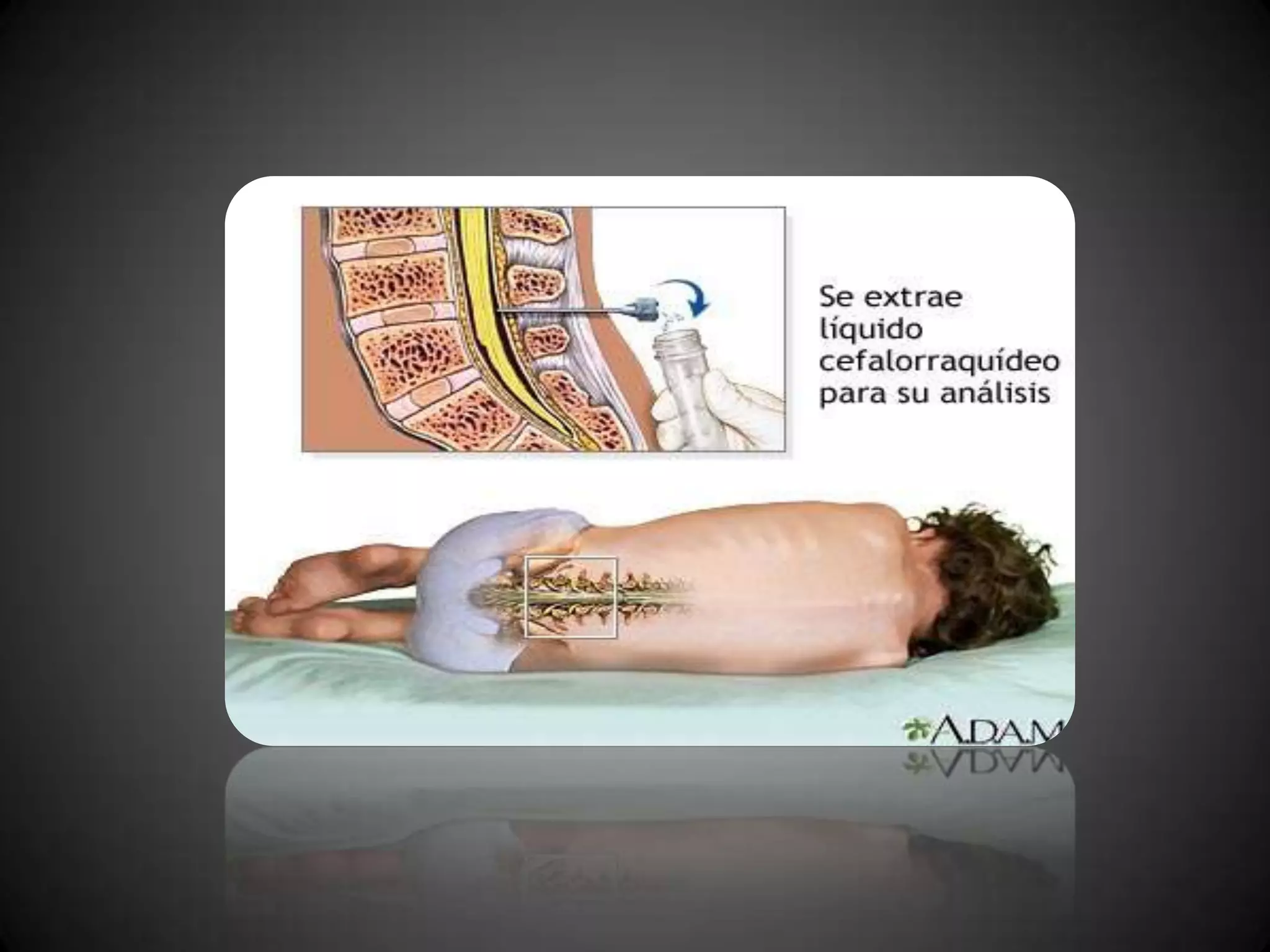 medula espinal, neuroanatomia casos clinicos | PPTX