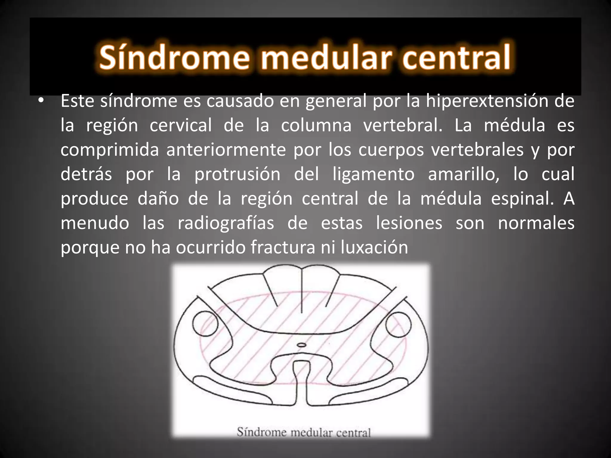 medula espinal, neuroanatomia casos clinicos | PPTX