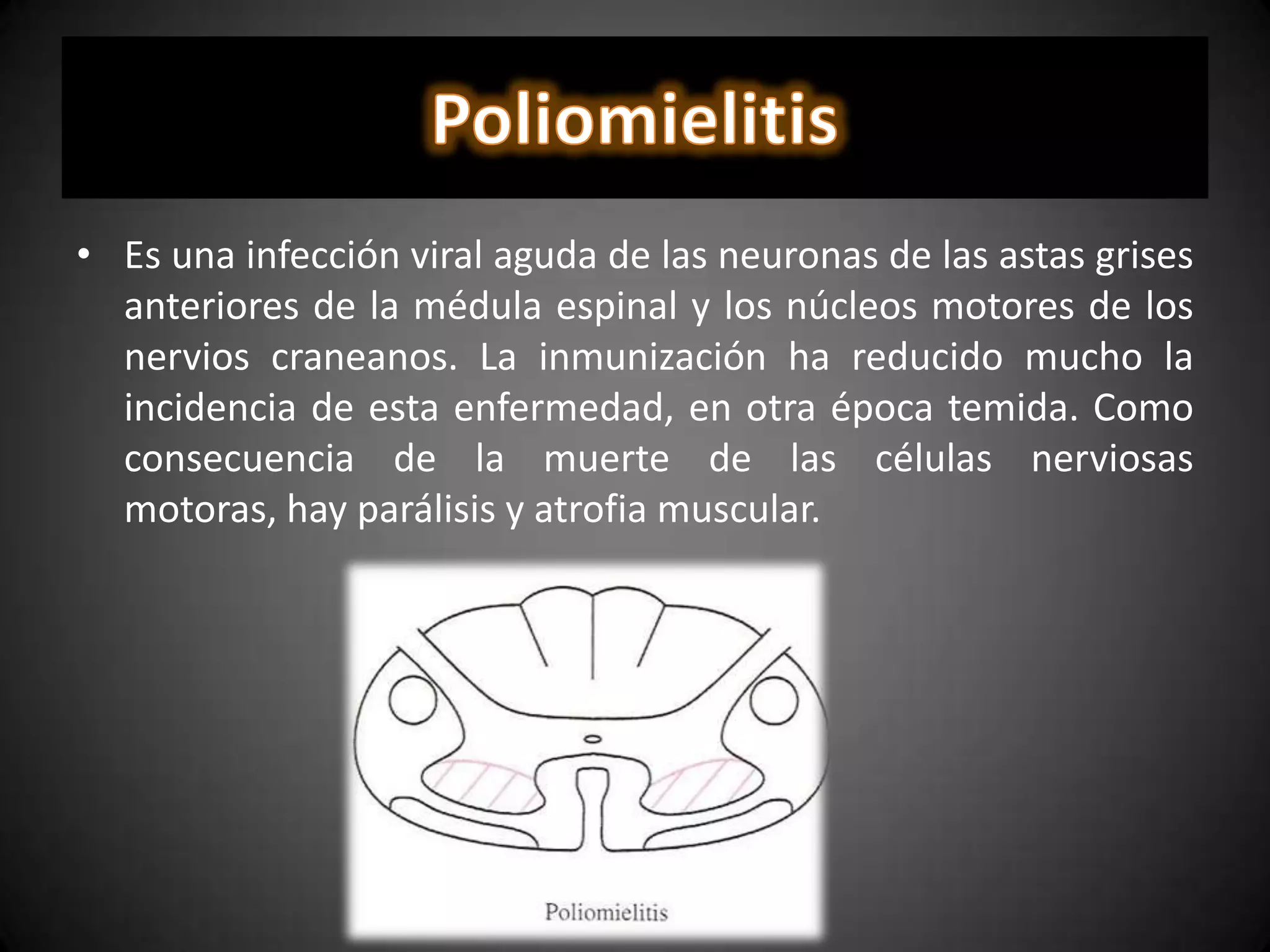medula espinal, neuroanatomia casos clinicos | PPTX