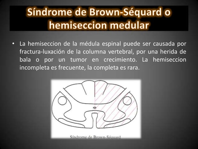 medula espinal, neuroanatomia casos clinicos | PPTX