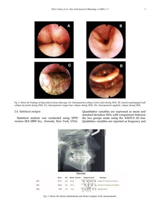 Correlation Between Drug-Induced Sleep Endoscopy and Lateral Ceph.pdf