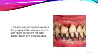 Correlation of clinical features of gingiva | PPTX