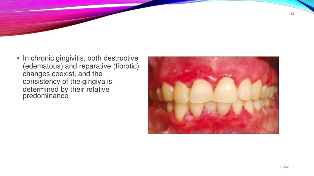 Correlation of clinical features of gingiva | PPTX