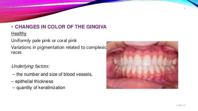Correlation of clinical features of gingiva | PPT