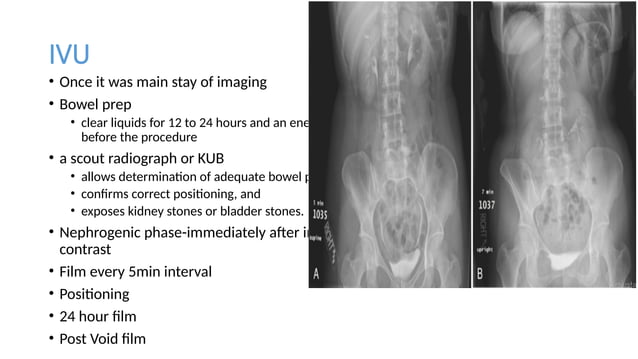 Correlation of CTU with renal scintigraphy in assessing split Renal ...