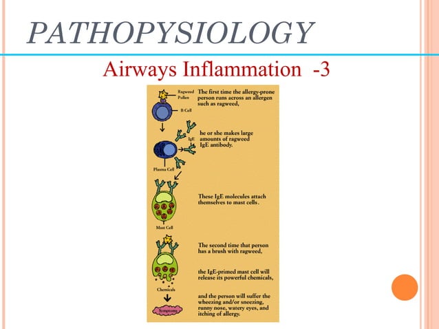 pathophysiology & immunity of asthma | PPT
