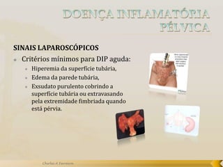 Corrimentos E DoençA InflamatóRia PéLvica | PPTX