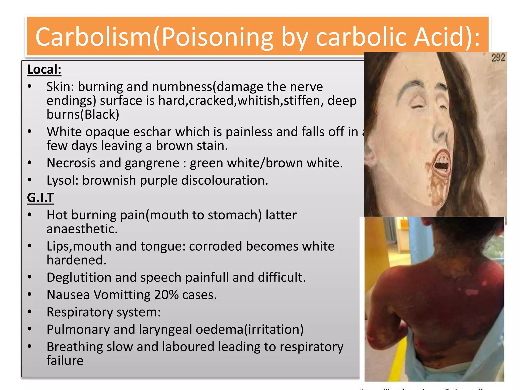 Corrosive poisons | PPTX | Digestive Disorders | Diseases and Conditions