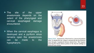 CORROSIVE ESOPHAGEAL INJURY.pptx