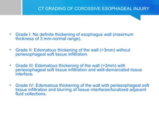 Corrosive injuries vishal | PPT