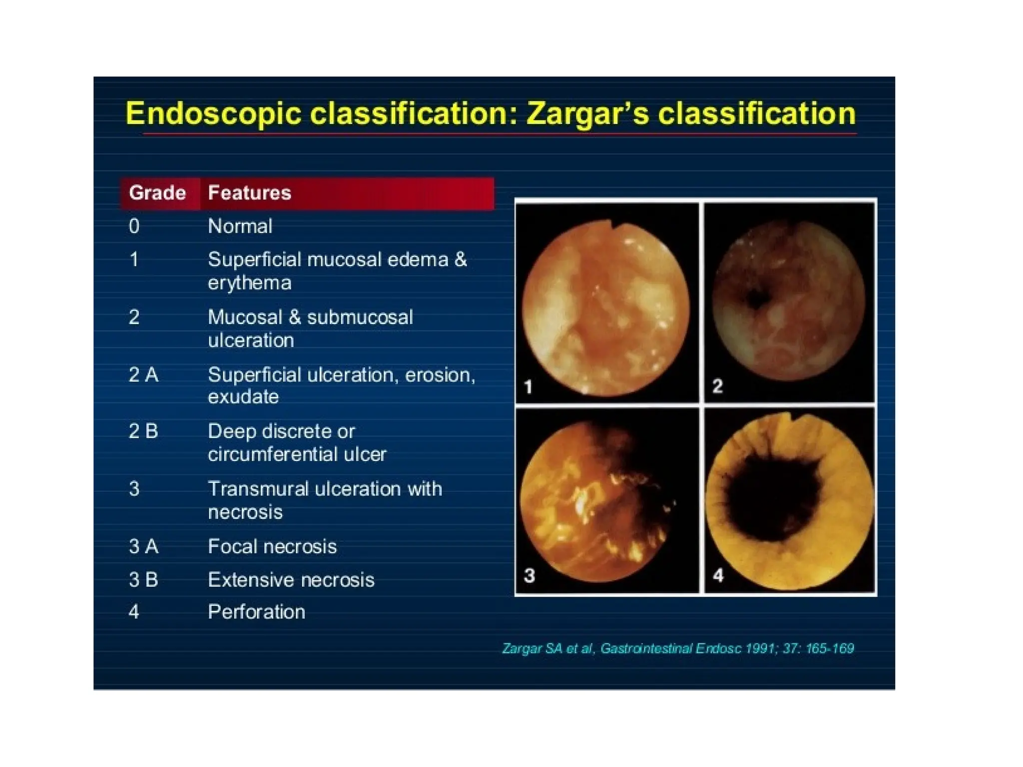 CORROSIVE INJURY.pptx : Diagnosis and treatment | PPT