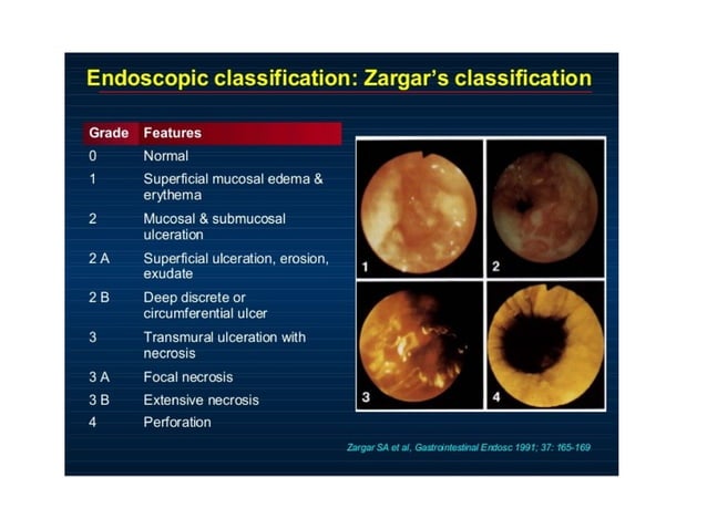CORROSIVE INJURY.pptx : Diagnosis and treatment | PPT