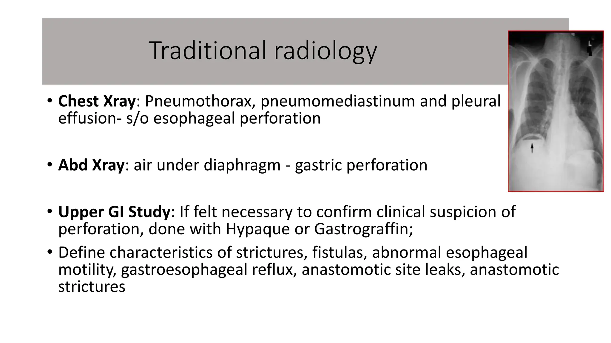 Corrosive injury review article and management.pptx