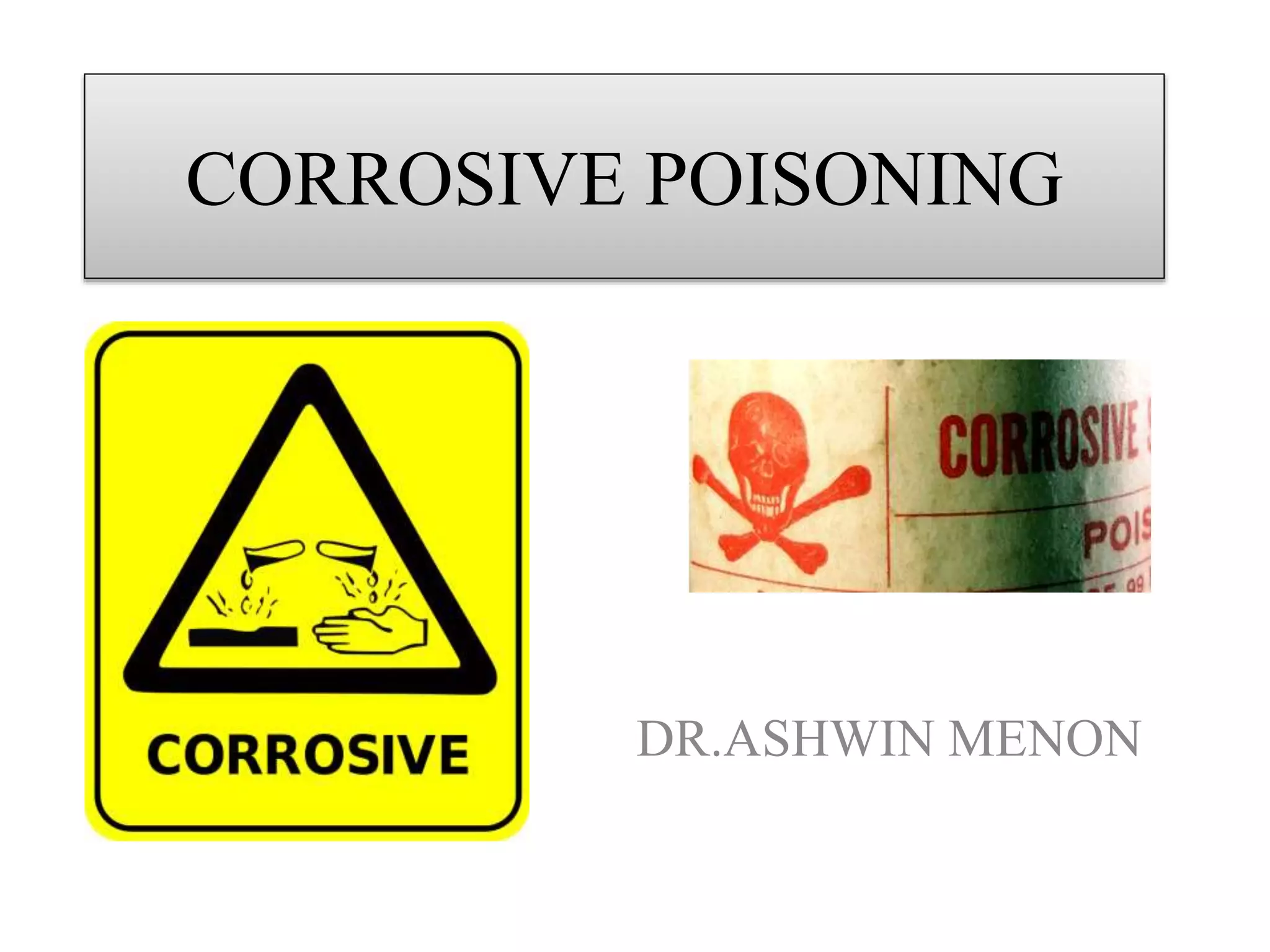Corrosive poisoning by Dr.Ashwin Menon | PPTX