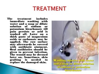 Corrosivepoisons | PPT