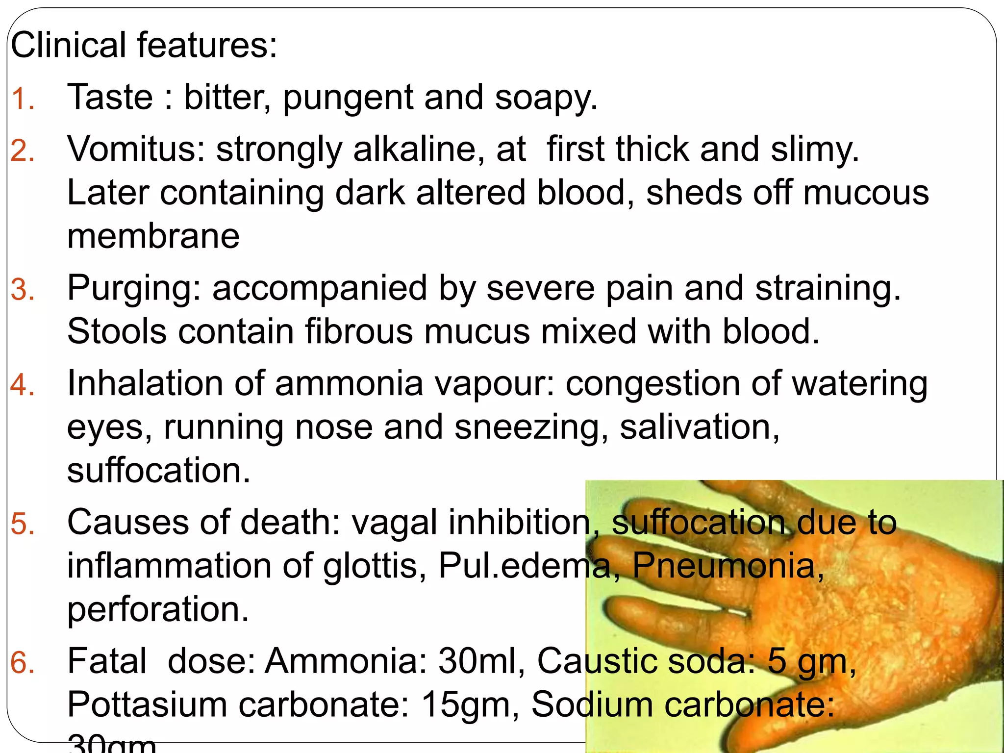 Corrosive poisons | PPTX