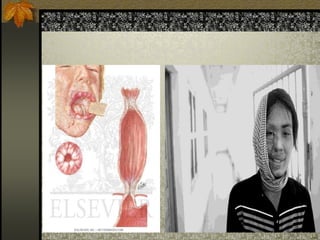 Corrosives/caustics | PPTX