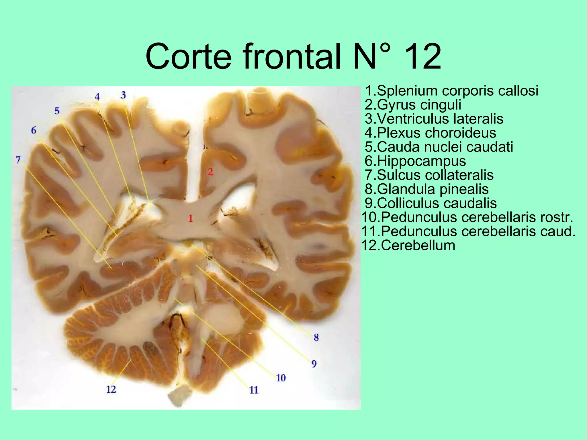 Corte coronal de encefalo | PPT