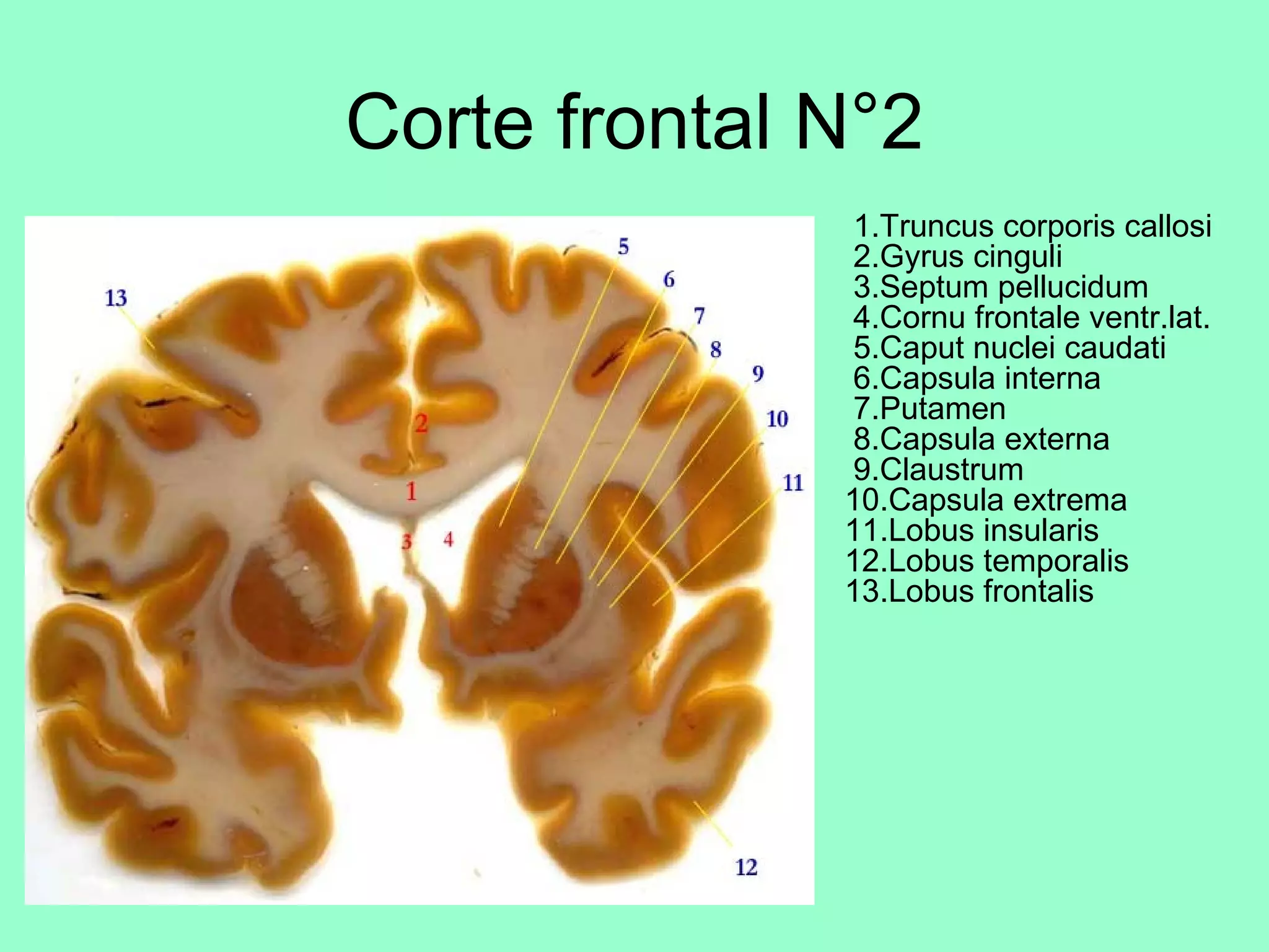 Corte coronal de encefalo | PPT