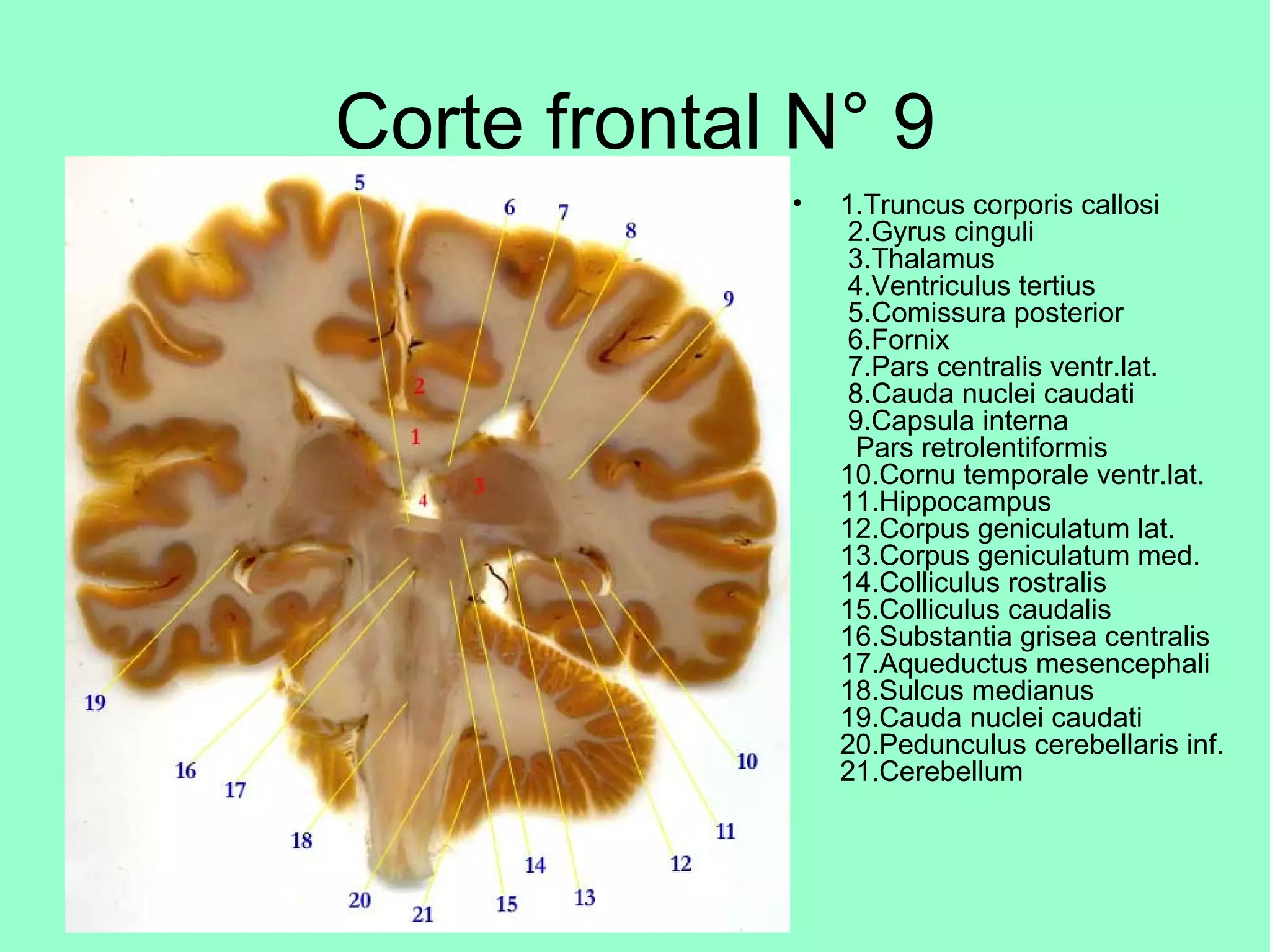 Corte coronal de encefalo | PPT