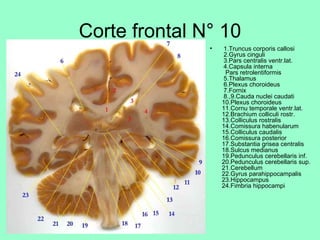 Corte coronal de encefalo | PPT