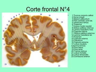 Corte coronal de encefalo | PPT