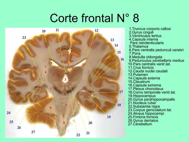 Corte coronal de encefalo | PPT