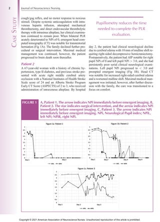 Neurological Pupil Index as an Indicator of Irreversible Cerebral Edema ...