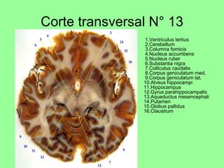 Corte transversal de encefalo | PPT