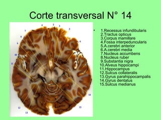 Corte transversal de encefalo | PPT