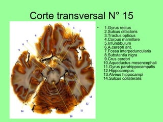 Corte transversal de encefalo | PPT