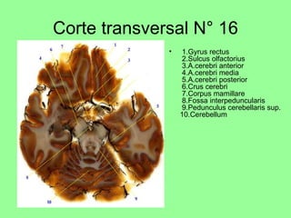 Corte transversal de encefalo | PPT