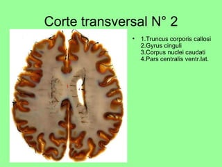 Corte transversal de encefalo | PPT