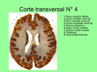 Corte transversal de encefalo | PPT