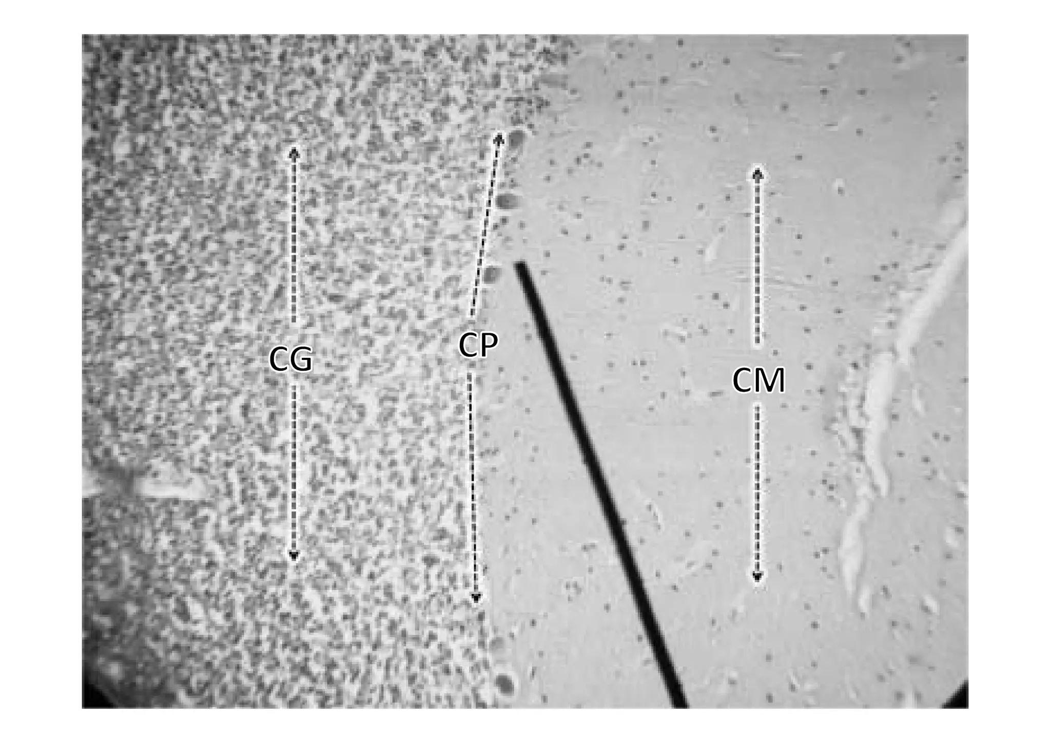Corteza cerebral y cerebelosa | PDF