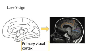 Cortical Anatomy & Function.pptx