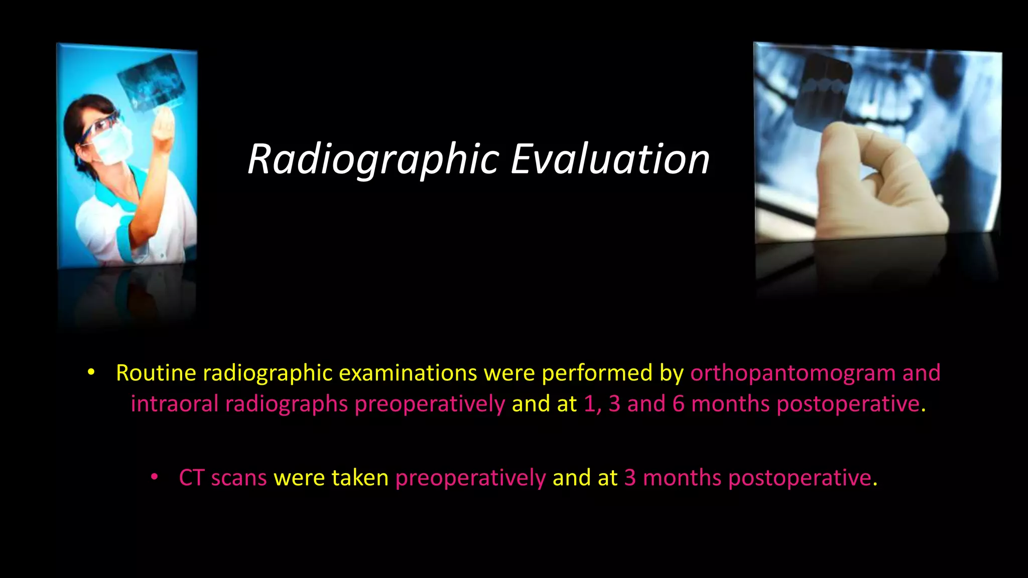 Cortical bone repositioning technique for horizontal alveolar bone ...