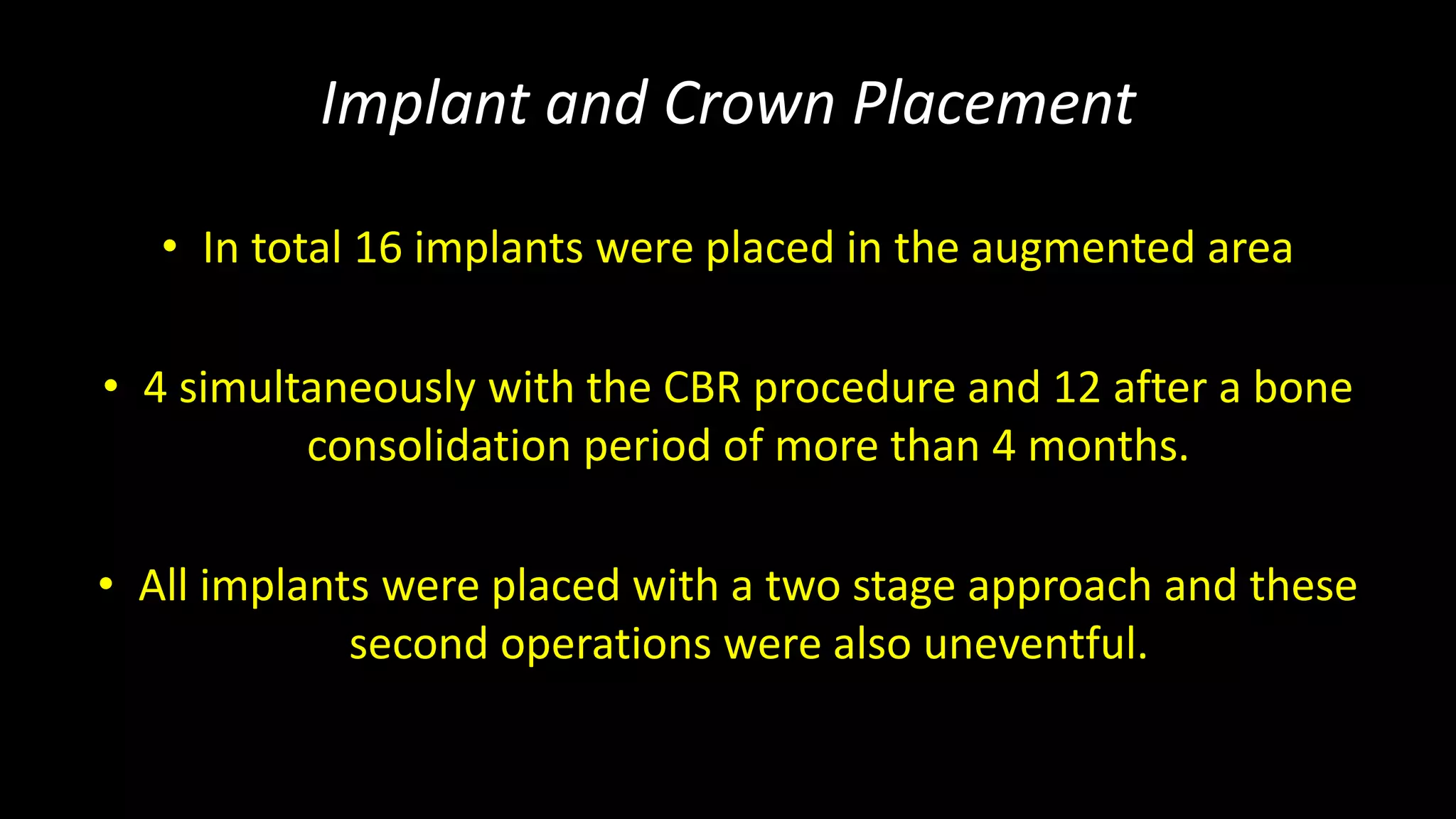 Cortical bone repositioning technique for horizontal alveolar bone ...