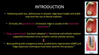 Cortical bone repositioning technique for horizontal alveolar bone ...