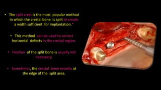 Cortical bone repositioning technique for horizontal alveolar bone ...