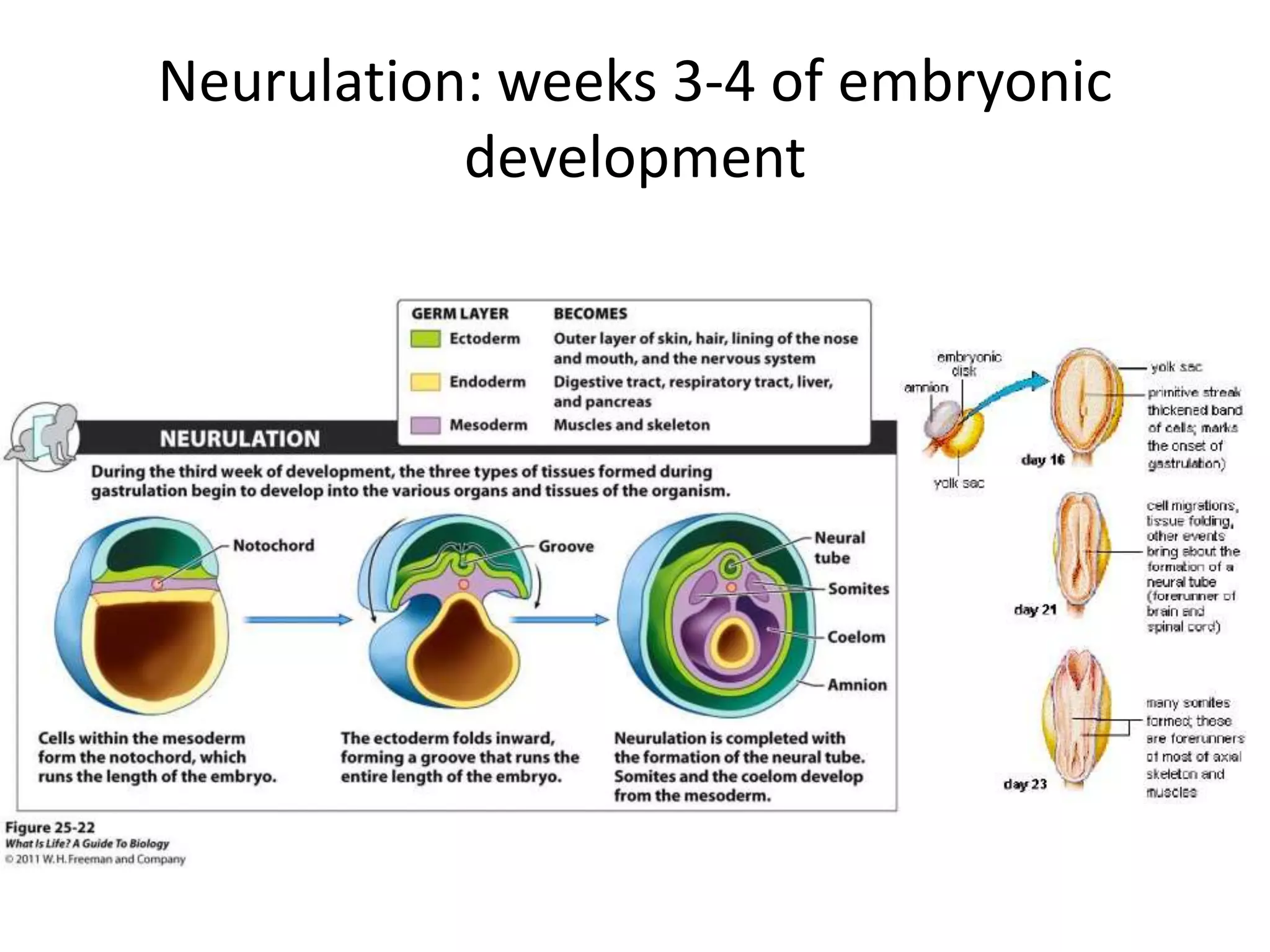Cortical dysplasia | PPTX