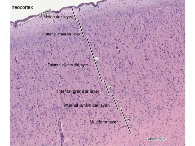 Cortical dysplasia