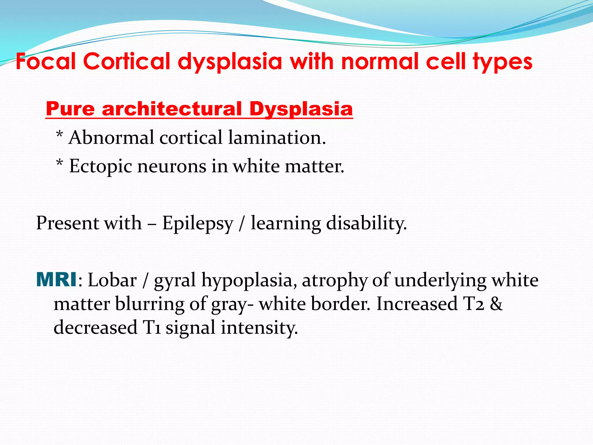Cortical dysplasia and epilepsy | PPTX