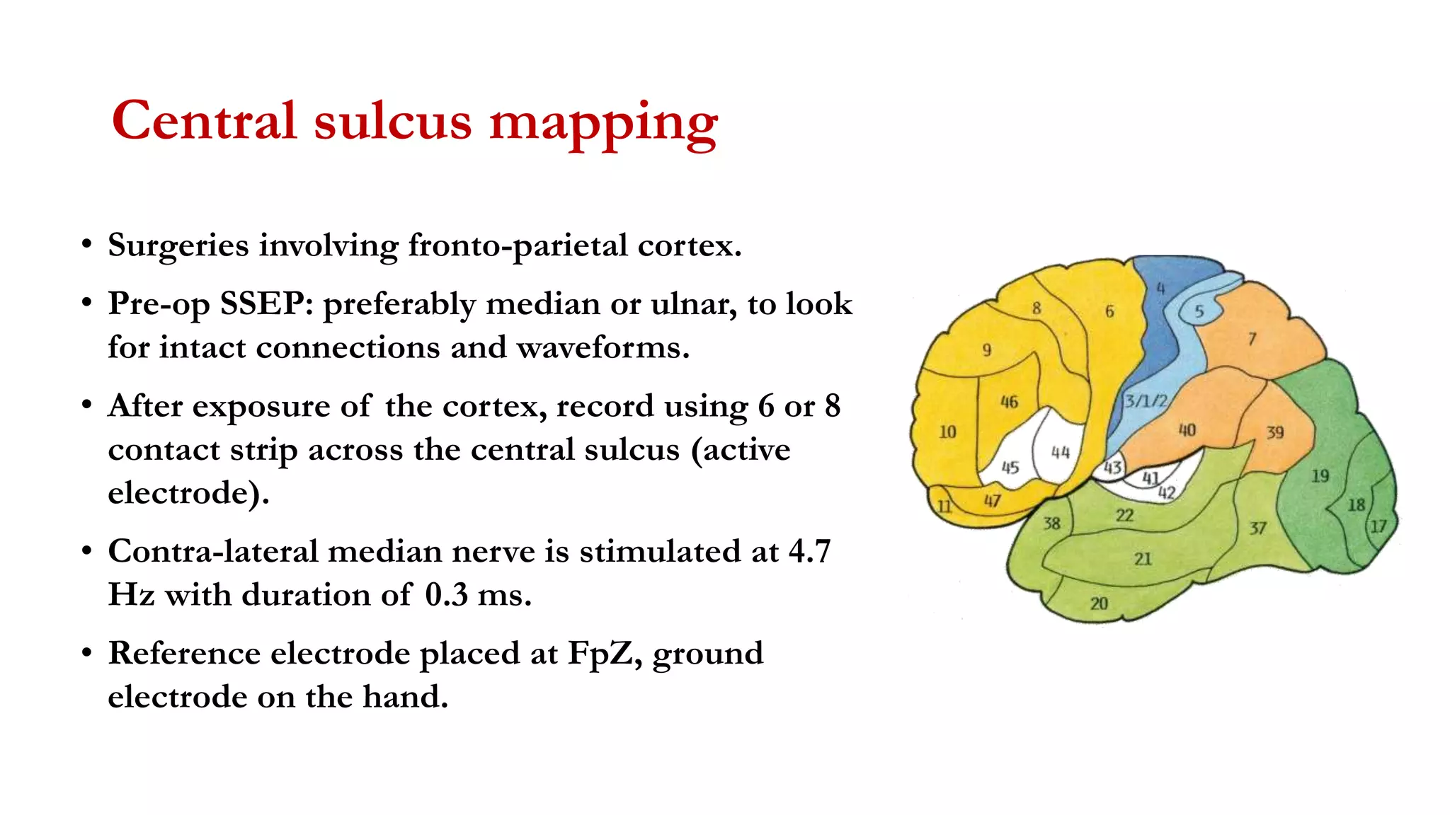 Cortical stimulation and mapping | PPTX