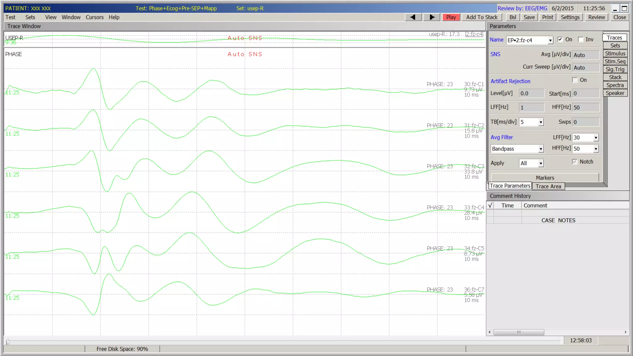 Cortical stimulation and mapping | PPTX
