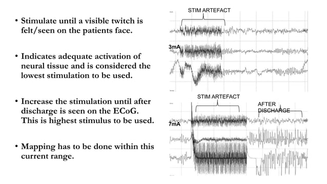 Cortical stimulation and mapping | PPTX | Brain and Nervous System ...