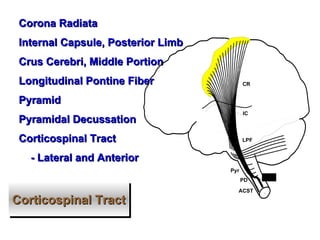 Corticospinal tract | PPT