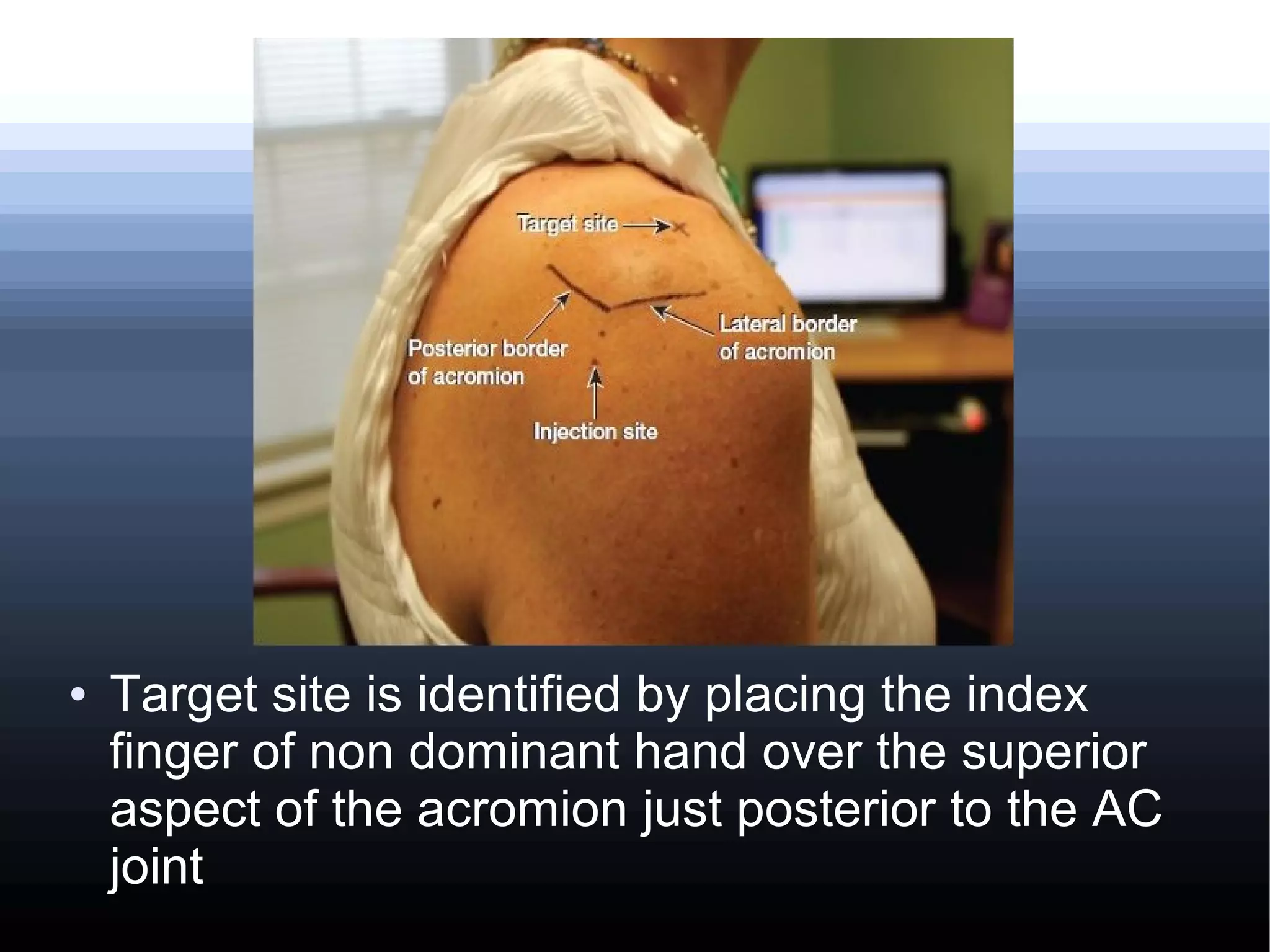 Corticosteroid injections in Orthopaedics | ODP