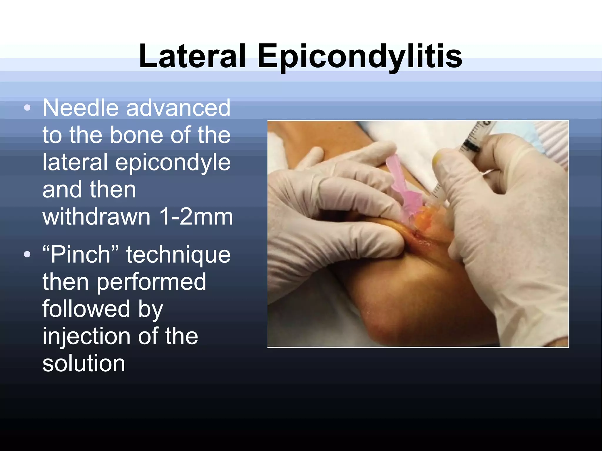 Corticosteroid injections in Orthopaedics | ODP