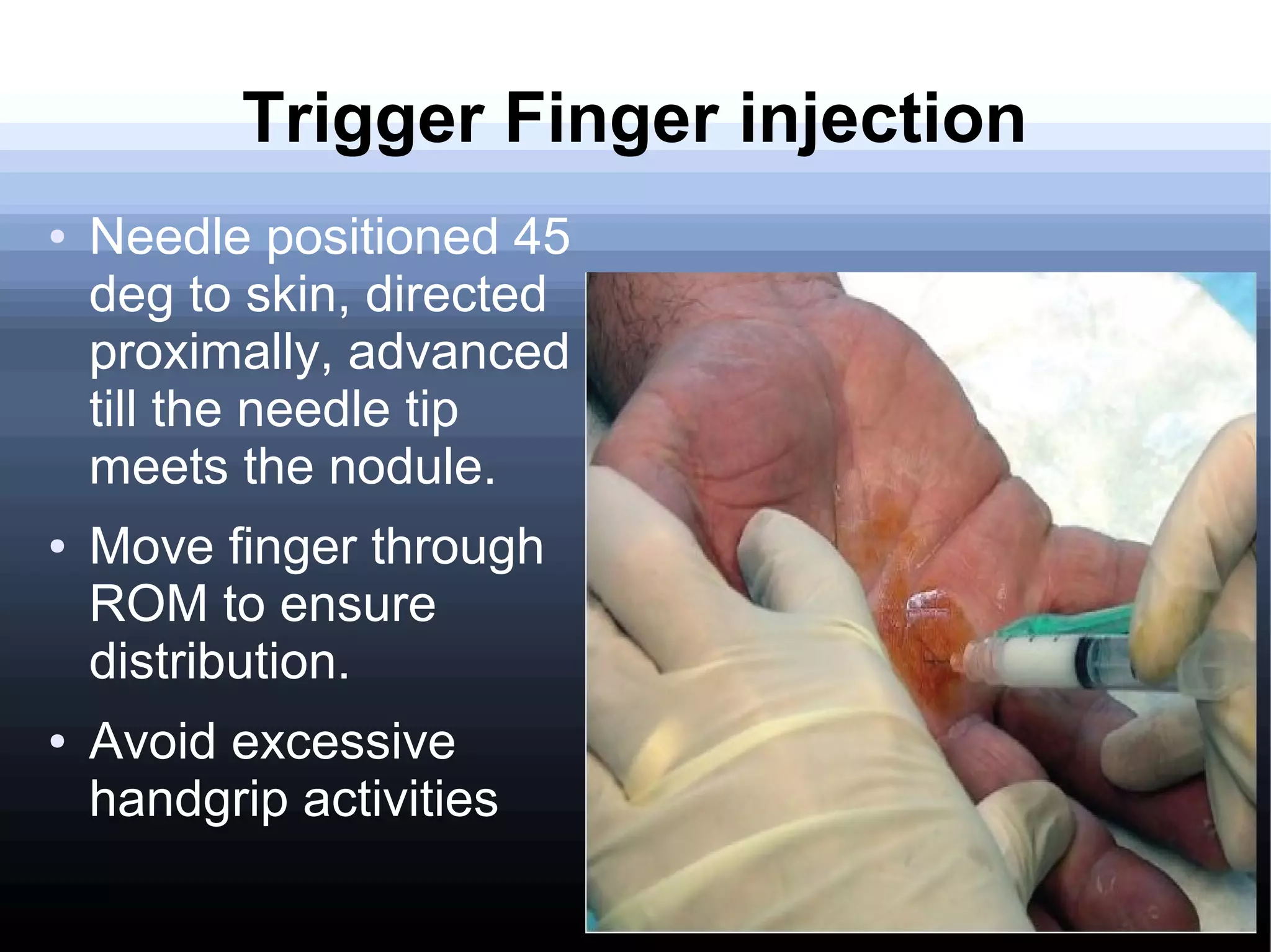 Corticosteroid injections in Orthopaedics | ODP